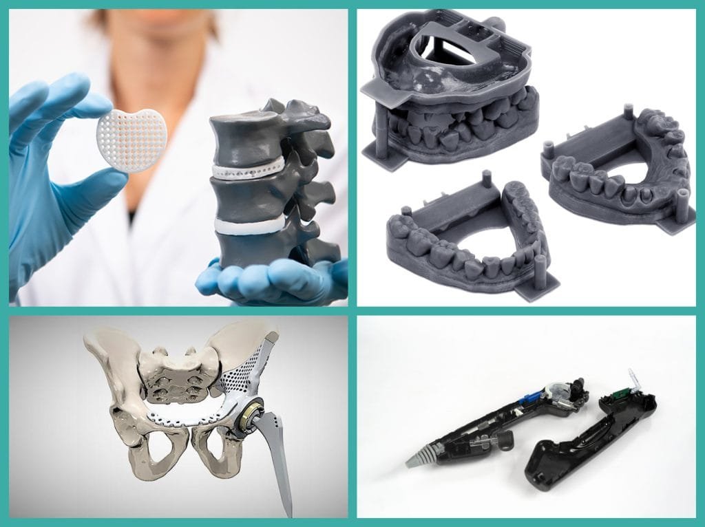 Medical 3D Printing Technology Services in Mumbai | Tesseract